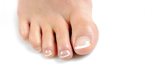 Onicocriptosis o uña encarnada - GrupFisioderm